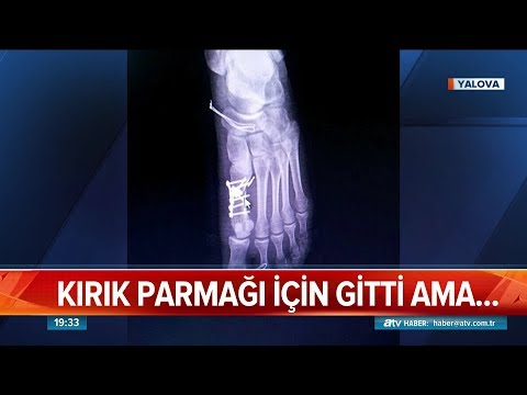 Doktor yanlış ayağı ameliyat etti! - Atv Haber 18 Temmuz