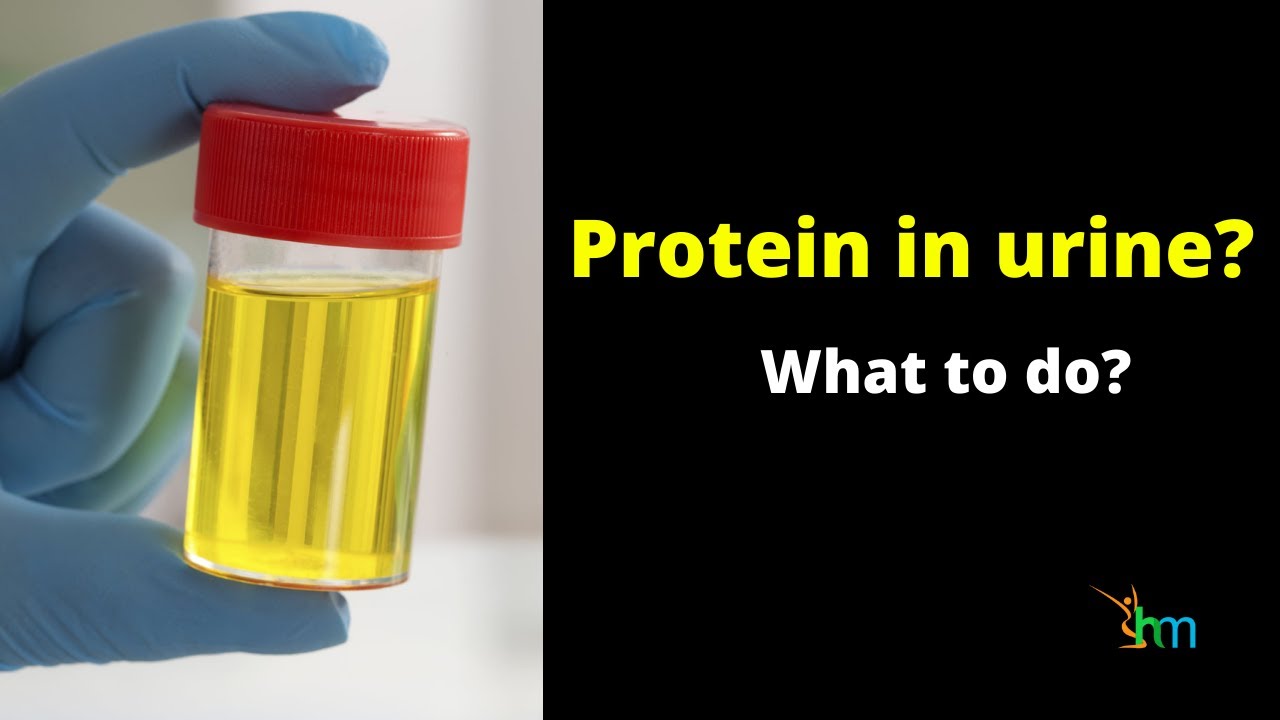 What Is The Cause Of Albumin In Urine Can It Be Cured Permanently