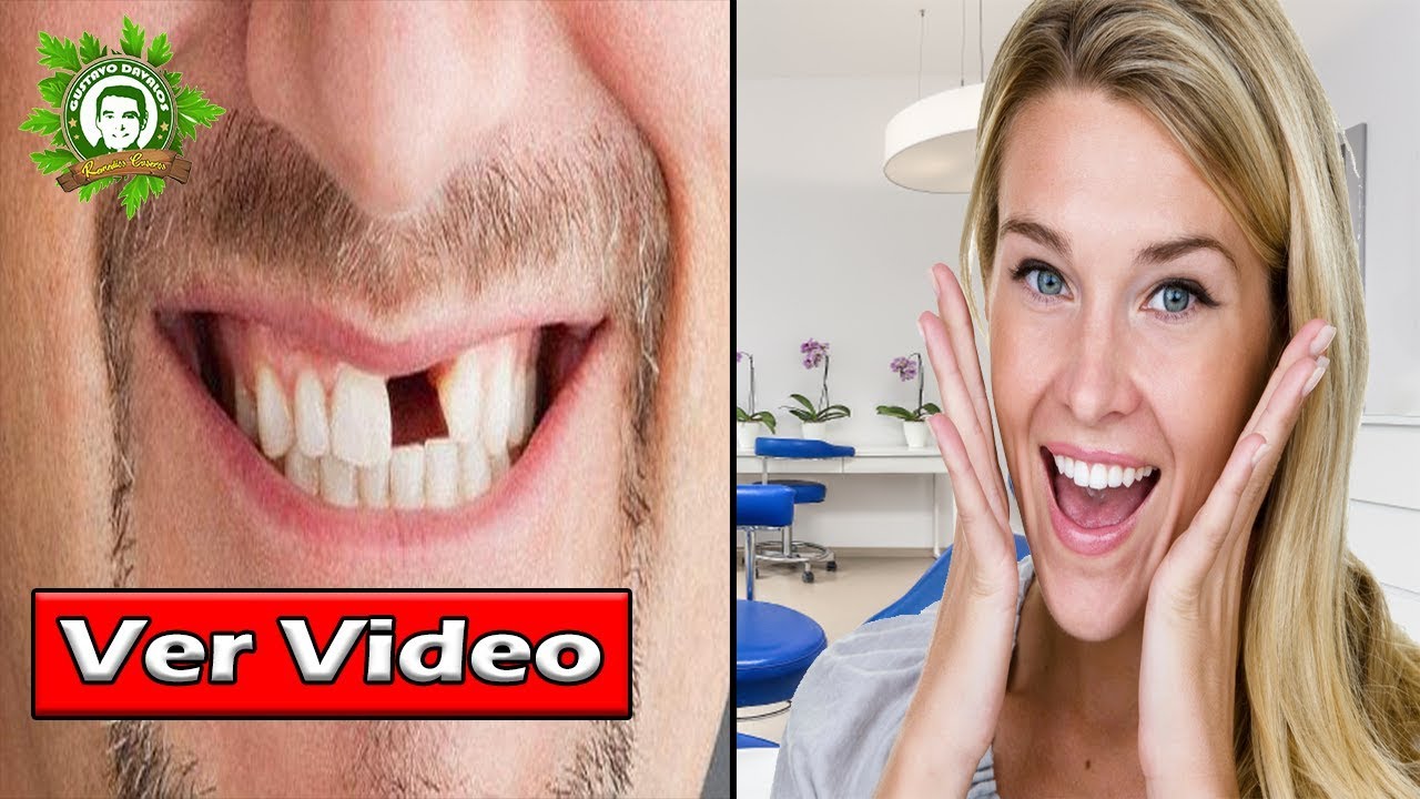 Aprende Como Fortalecer Tus Dientes Flojos y Tambaleantes Con Estos ...