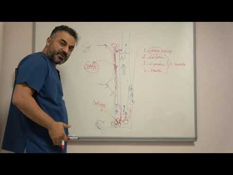 Rahim ameliyatı sonrası bacakta Dolaşım bozukluğu - Prof. Dr. Ahmet AKGUL