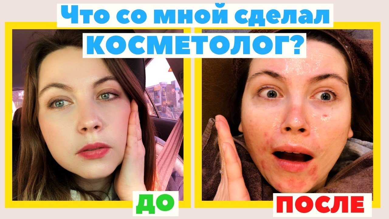 Косметология в Корее Лечение прыщей на лице Youtube