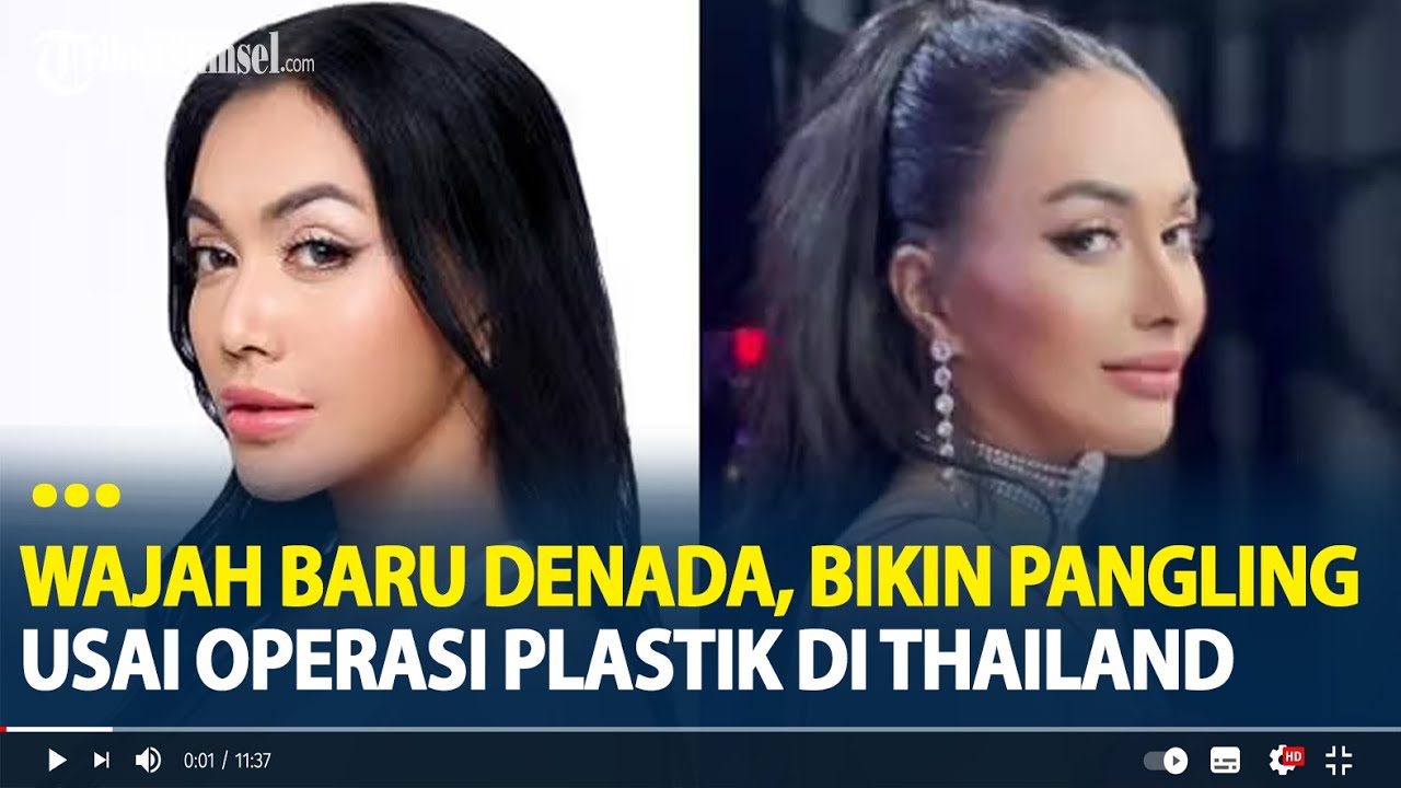 Potret Wajah Baru Denada, Bikin Pangling usai Operasi Plastik di ...