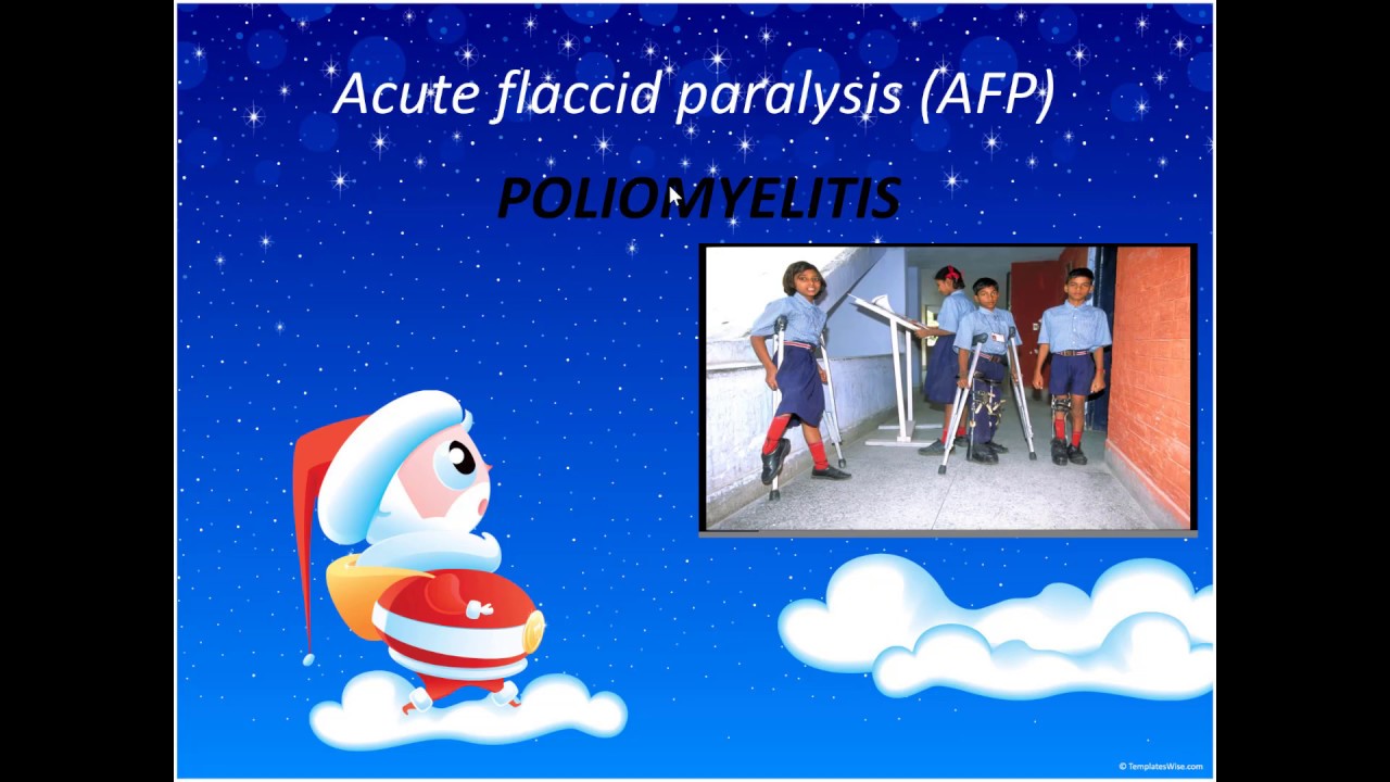 Acute Flaccid Paralysis (Pediatrics) - YouTube