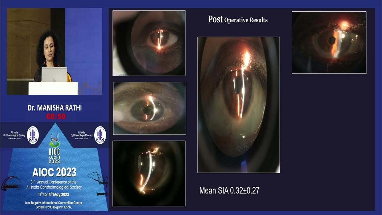 AIOC 2023 - GP136 - topic Jagannath Boramani MAGIC OF SICS - I - YouTube