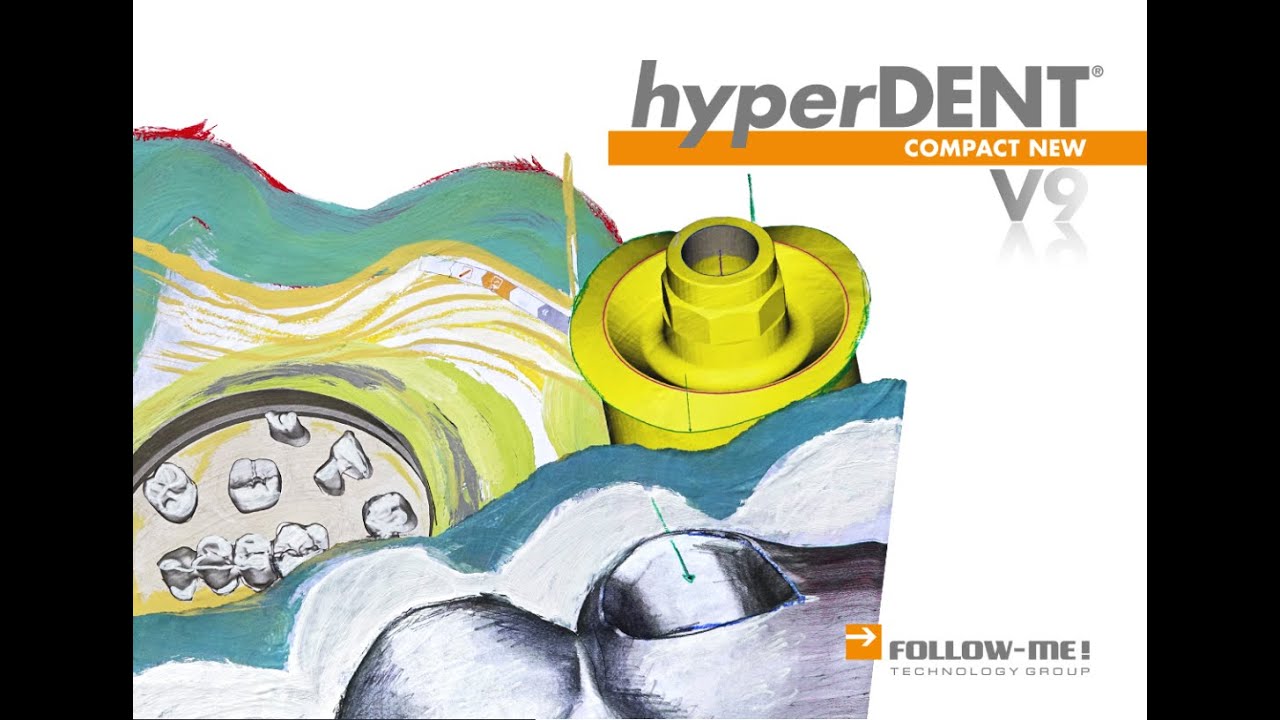 hyperDENT v9.4.3 - hyperDENT Compact NEW v9.4.3 - hyperDENT DGShape v9.4.3 || 2024 || - YouTube