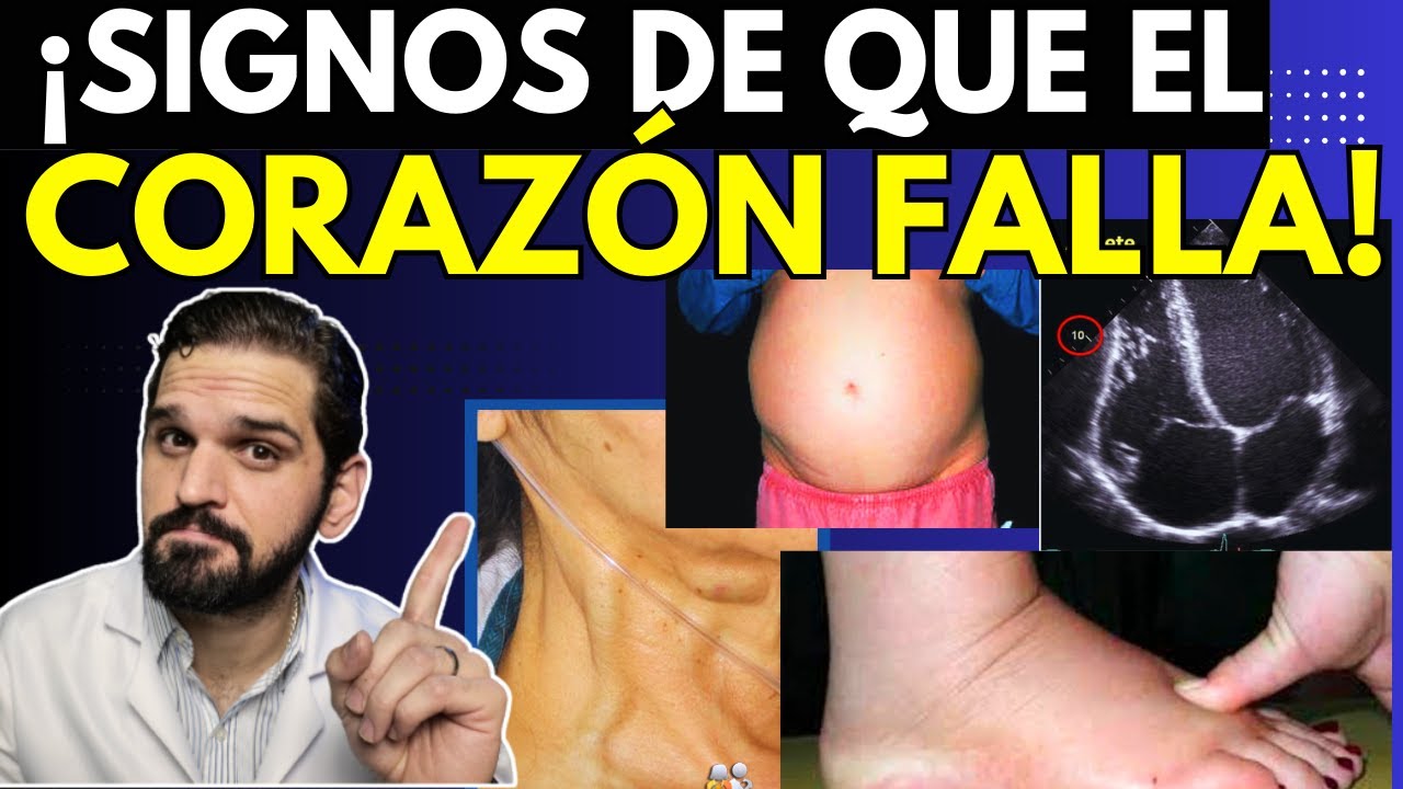 Entendiendo la Falla Cardíaca: Guía para Pacientes - YouTube