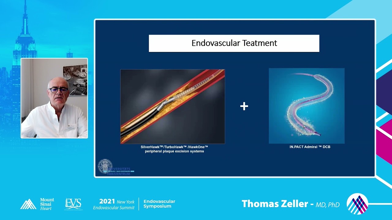 1h25pm EVS October 15 2021 Thomas Zeller, MD, PhD The PESTO CFA Study ...