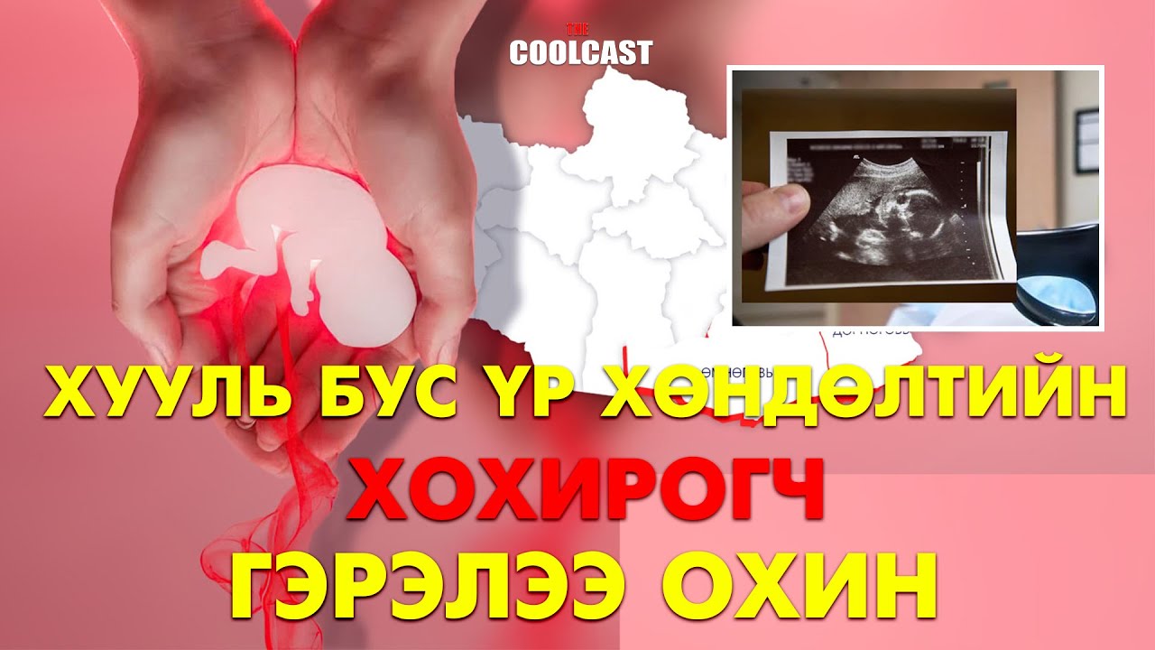 Гэрэлээ охины хэрэг ба хууль бус үр хөндөлт Youtube