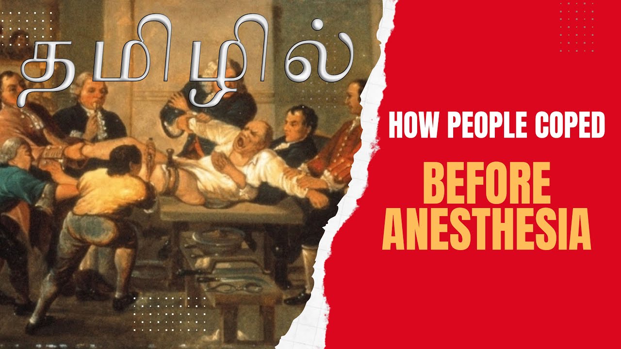 Surgery without Anaesthesia in Past மயக்க மருந்து அறுவை சிகிச்சைக்கு ...