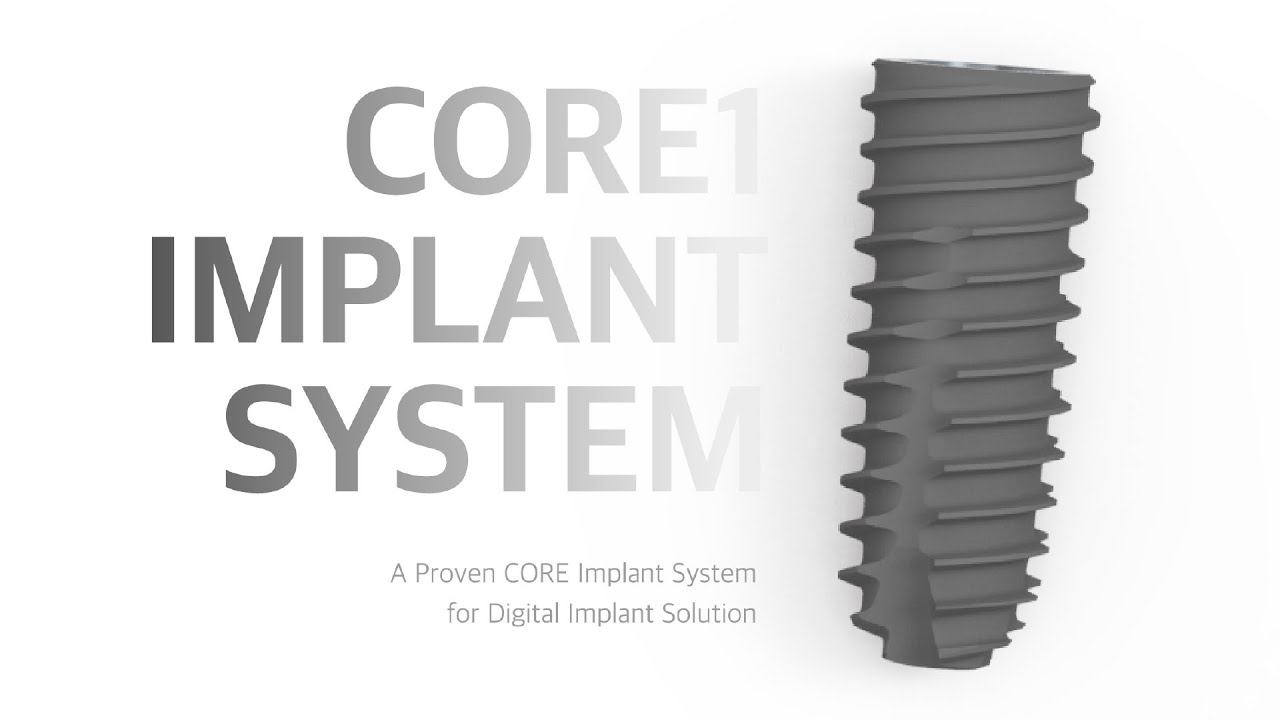 CORE1 IMPLANT SYSTEM | PLASMA ACTIVATOR - YouTube