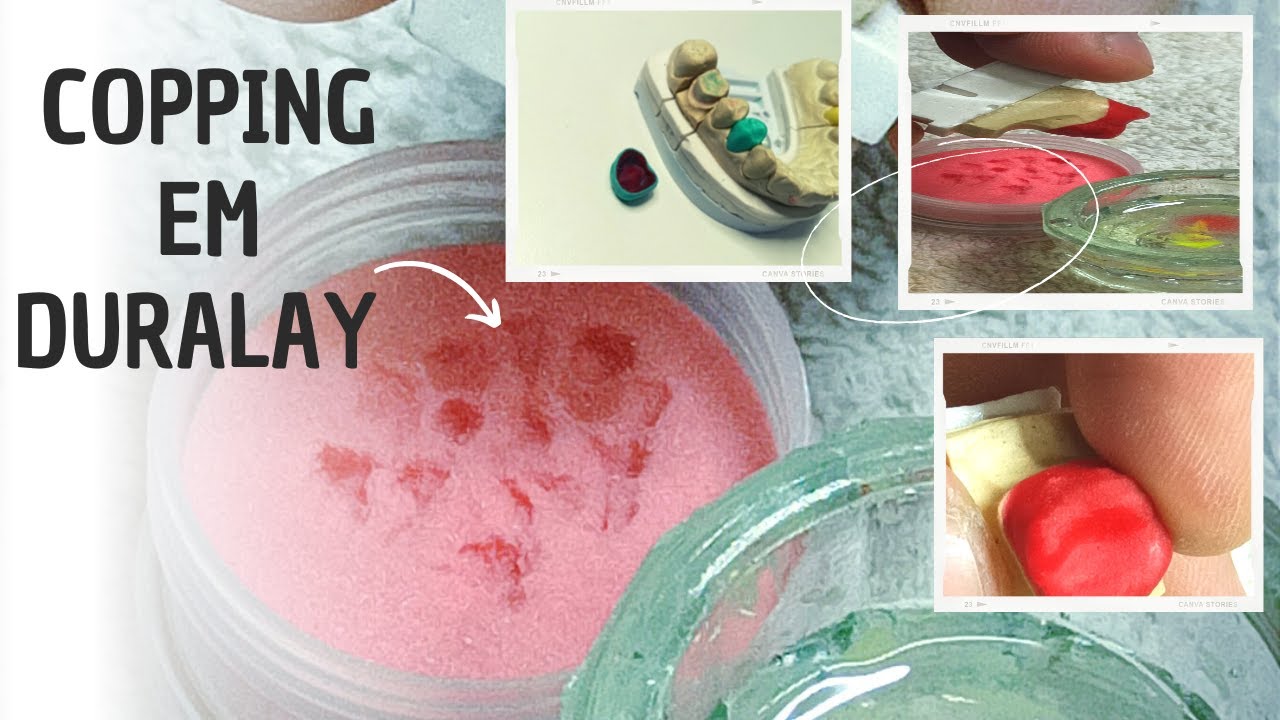Copping em duralay. Fixa1 - YouTube