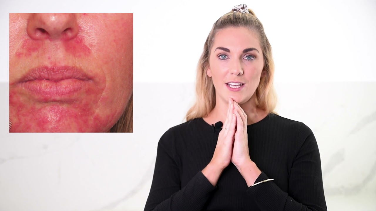 How To Treat Skin Redness | Rosacea - it's Causes and Treatments - YouTube