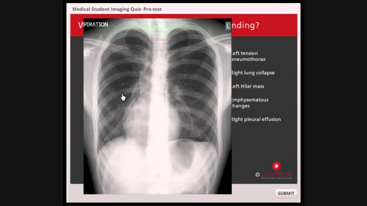 Medical Student Radiology Quiz - YouTube