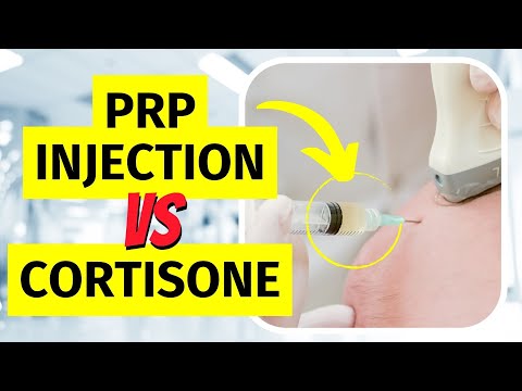 PRP vs Cortisone Injection for Tennis Elbow