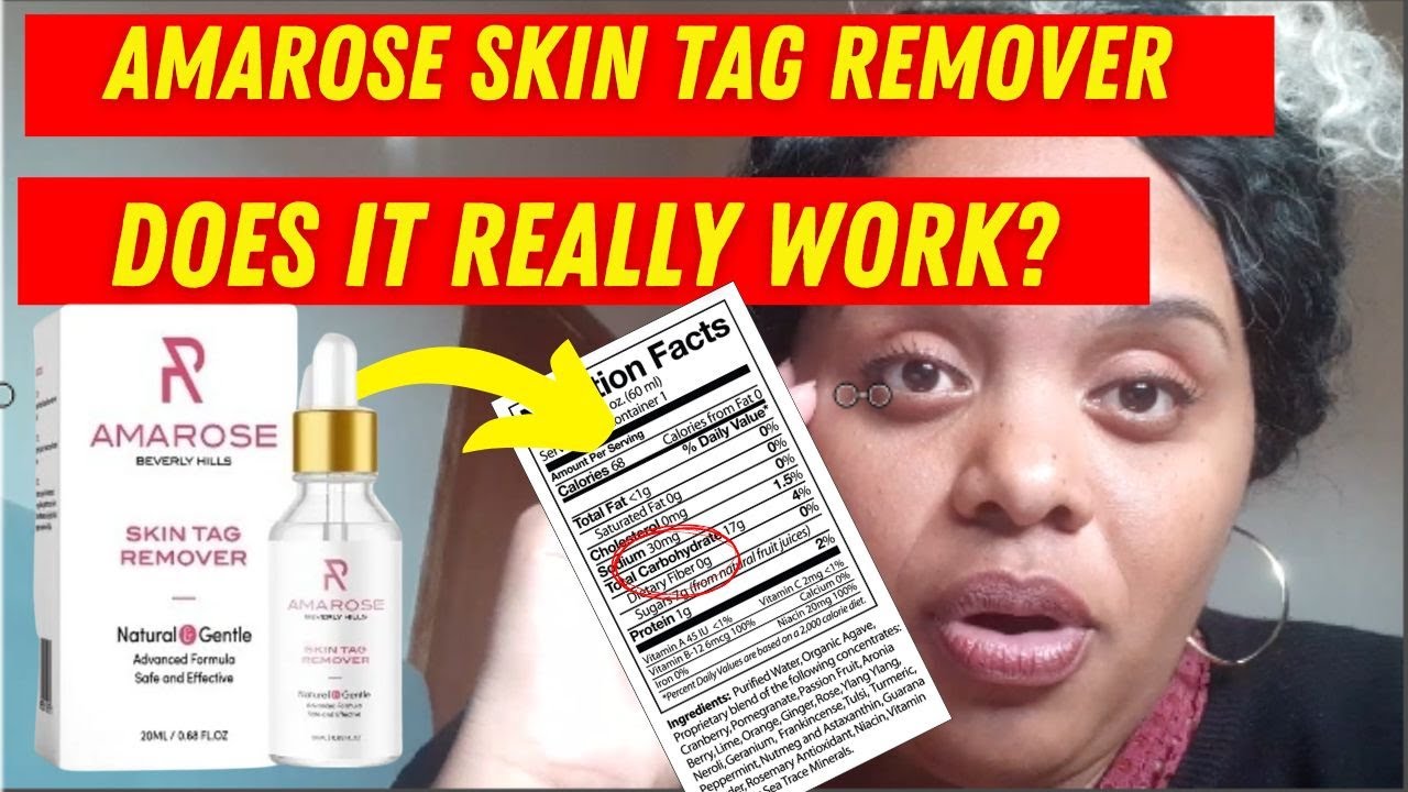 Amarose Skin Tag Remover Review - (BE CAREFUL!) Amarose Skin Tag Remove ...