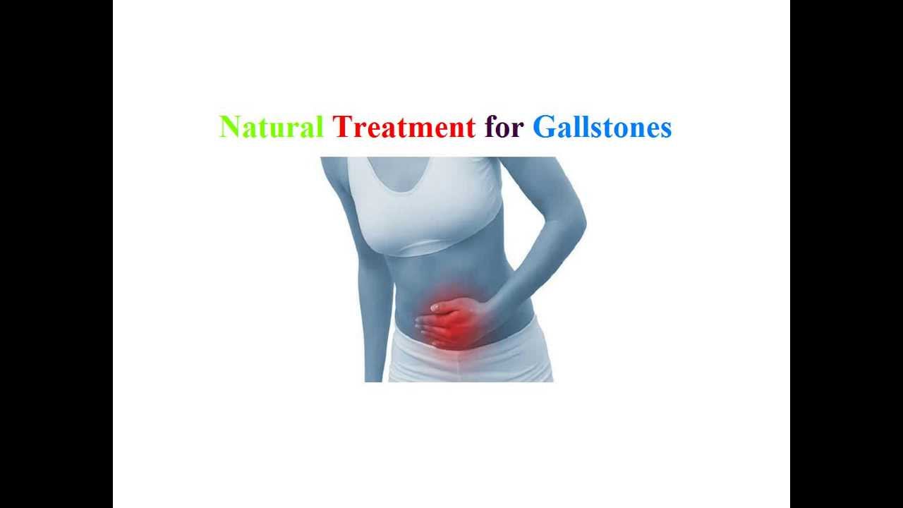 Cure Gallstones Naturally - Cure Gallstones Naturally Fast - YouTube