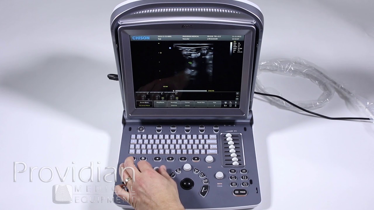 Chison ECO5 ECO 6 Training Part 4: Measurements and Annotations - YouTube