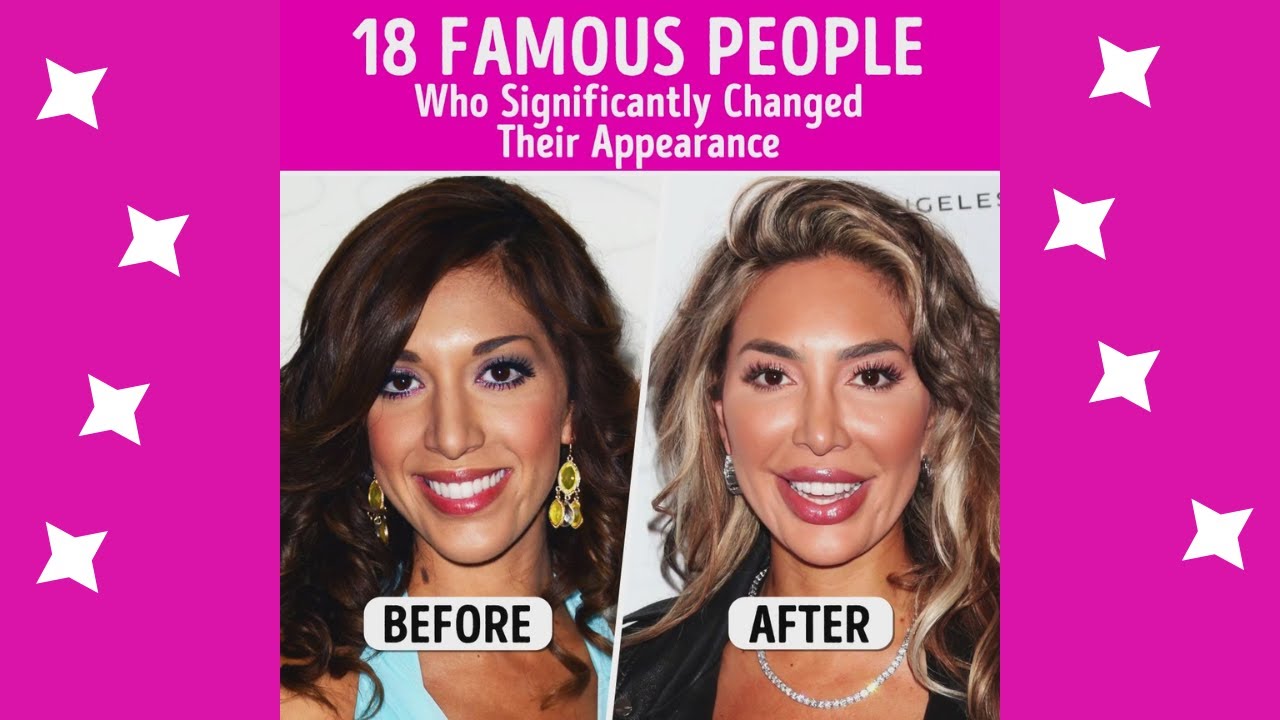 18 Famous People Who Significantly Changed Their Appearance - YouTube