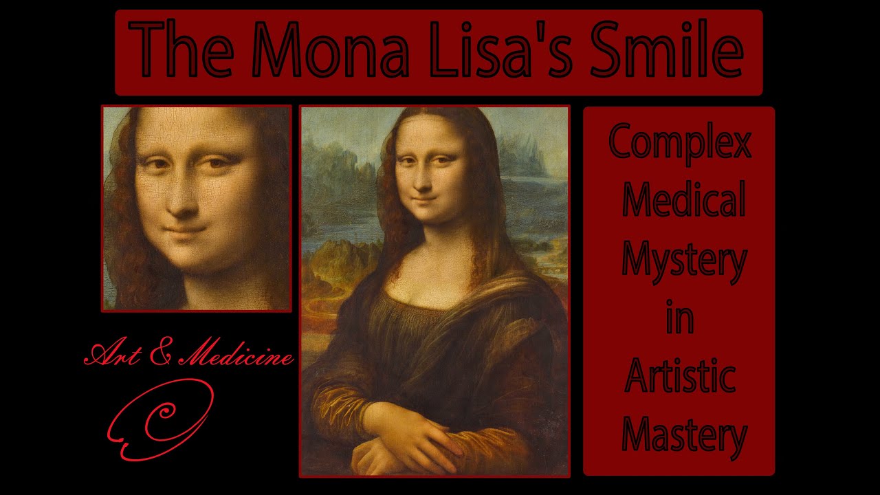 The Mona Lisa's Smile; A Complex Medical Mystery in Artistic Mastery ...