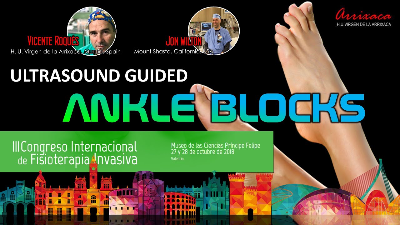 ULTRASOUND GUIDED ANKLE BLOCK - YouTube