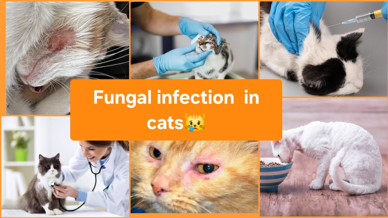 Sign& Symptoms Causes Treatment & Prevention of Fungal infection in ...