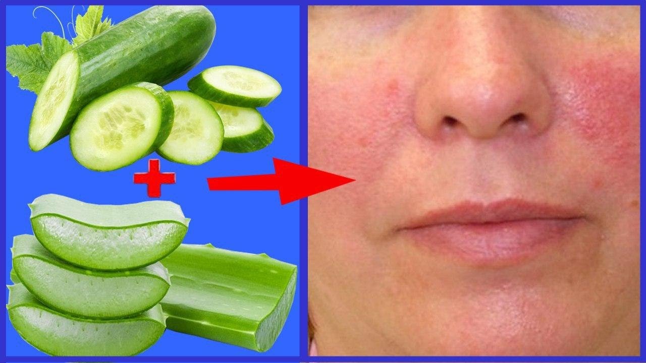 How To Get Rid of Redness on Your Face Fast With Cucumber and Aloe Vera ...