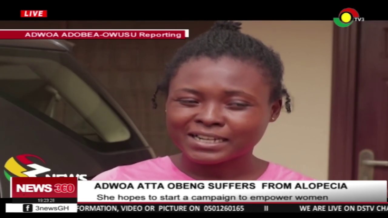 Adwoa Atta Obeng who suffers from alopecia starts a campaign to empower women - YouTube