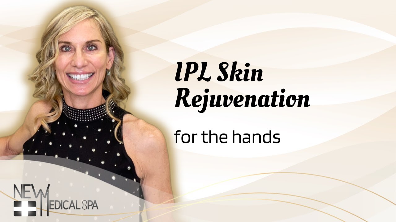 IPL Skin Rejuvenation for the Hands | New Medical Spa - YouTube