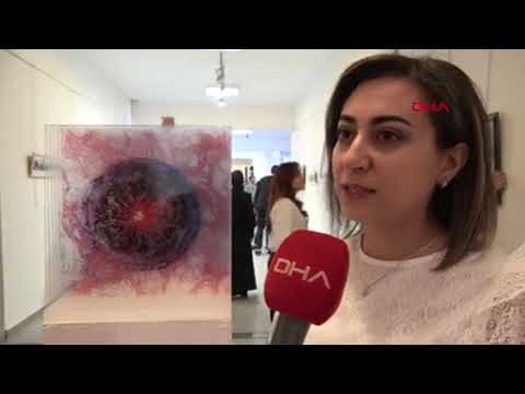 Migren Atakları Sırasında Gözünün Önüne Gelen Şekilleri Resimle Anlattı