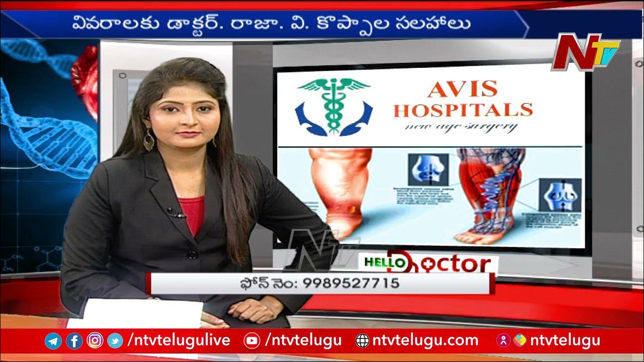Varicose Veins Types and Treatment | Dr. Rajah V Koppala Suggestions | AVIS Hospitals | N Health ...