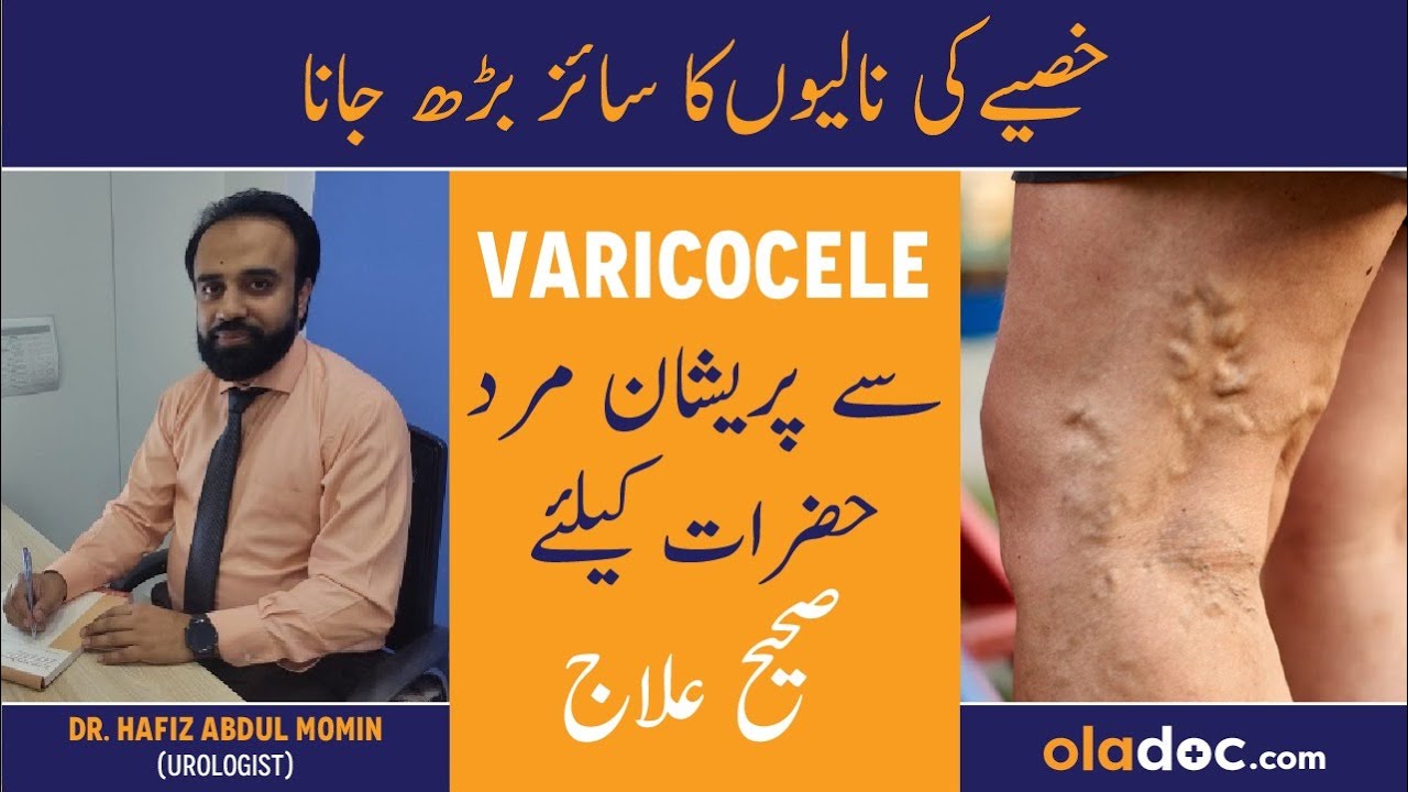 Varicocele Treatment In Urdu Varicocele Ka Ilaj Varicocele Kya Hota
