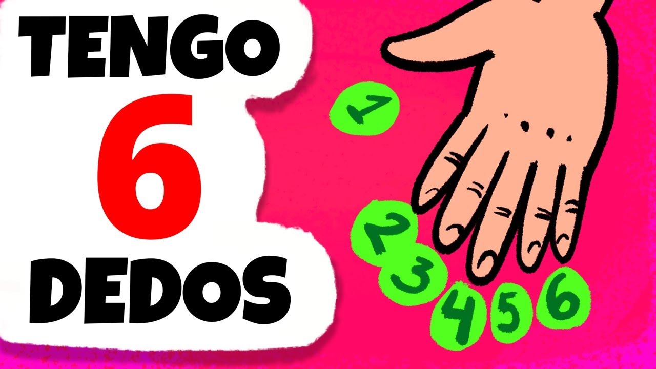 Tengo hexadactilia, es decir, ¡tengo 6 dedos en mi mano! - YouTube