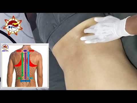 Cara cepat belajar Totok Punggung. General Treatment V.2 #totokpunggung #belajar #sehatalami #cara
