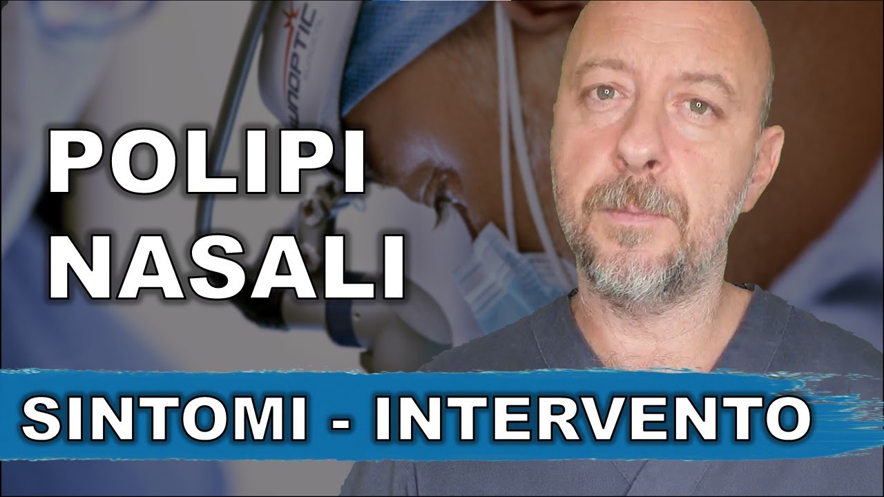 POLIPI NASALI sintomi ed intervento: QUANDO PREOCCUPARSI. - YouTube