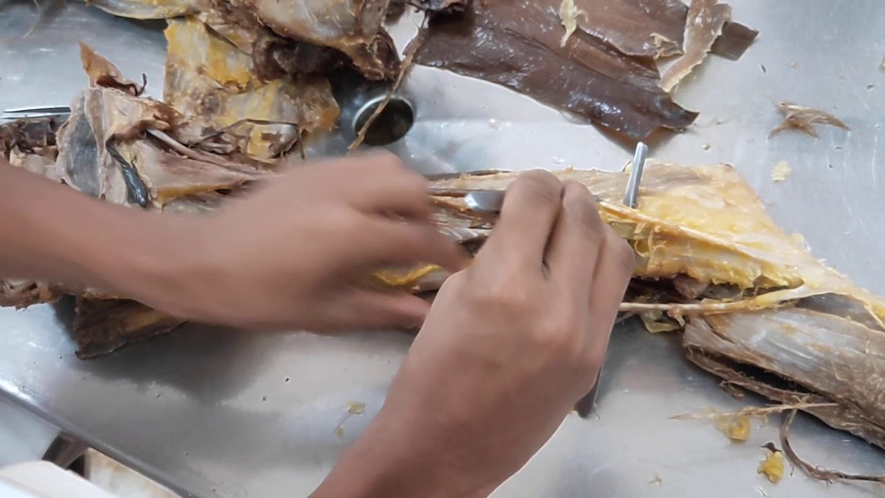 muscles of Guy ropes - YouTube