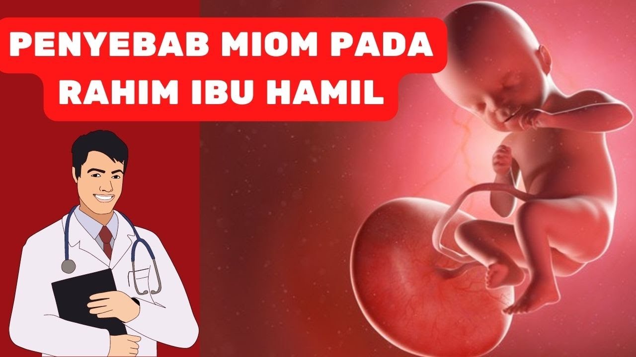 Mengalami Miom Saat Hamil, Bahayakah? - YouTube