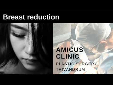 Reduction mammaplasty | Breast reduction | Slideshow