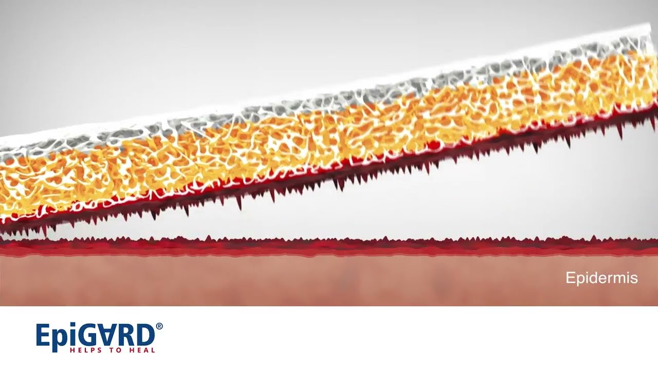 EPIGARD animation - YouTube