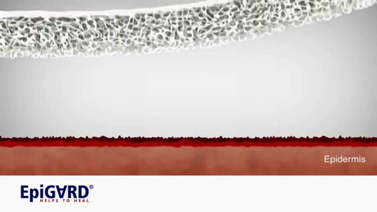 EPIGARD animation - YouTube