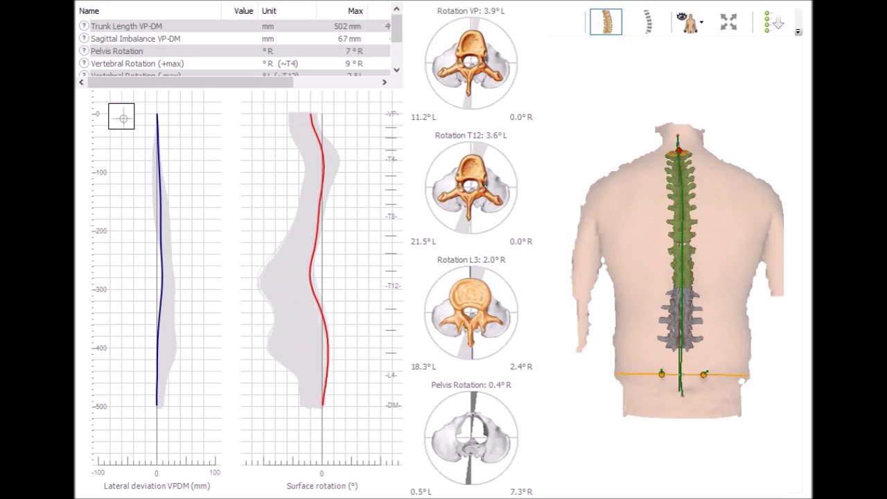 FCE Scan Spinal & Pelvic analysis - YouTube