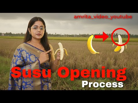 Baby Boy Private Part Open Kaise Kare | How To Open Baby Boy Susu | Phimosis | Baby Boy Susu Opening
