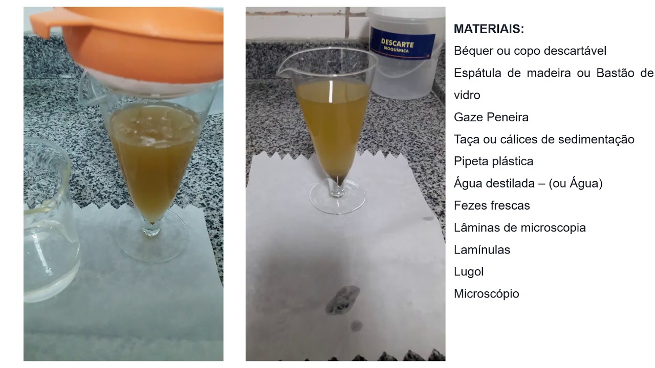 Aula Prática - Método de Hoffman, Pons e Janer (sedimentação espontânea ...