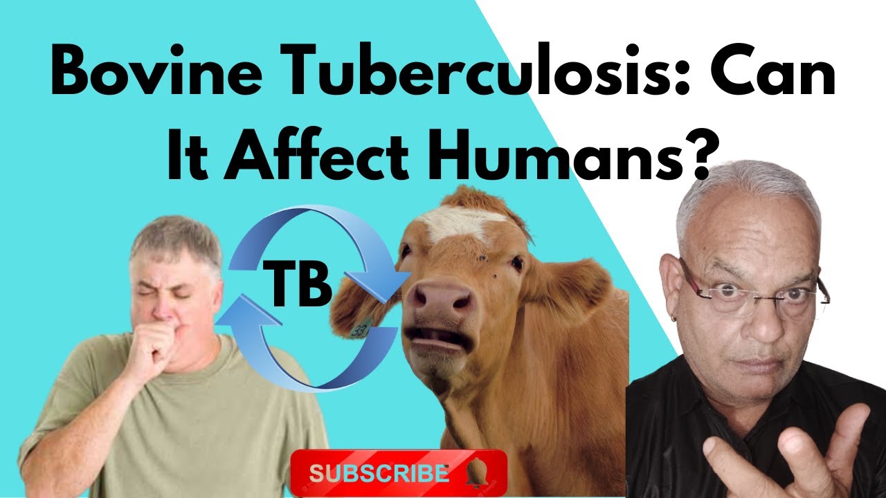 Bovine Tuberculosis: Can It Affect Humans? Exploring the Risks and ...