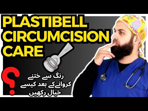 SECRETS of Plastibell Ring Circumcision Care - YouTube
