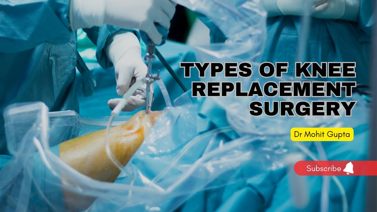 Types of Knee Replacement Surgery | Dr Mohit Gupta | Orthopedic Surgeon ...