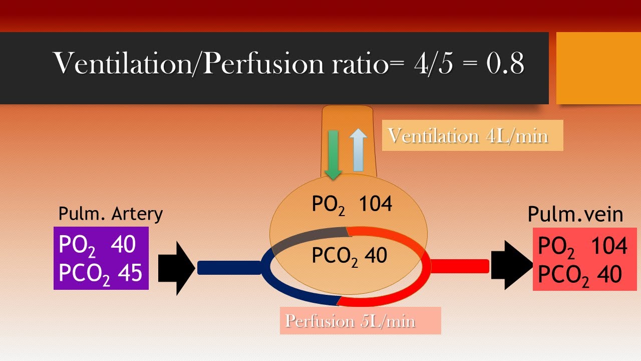 Physiology Lecture Bits: V/Q ratio in Health & Disease - YouTube
