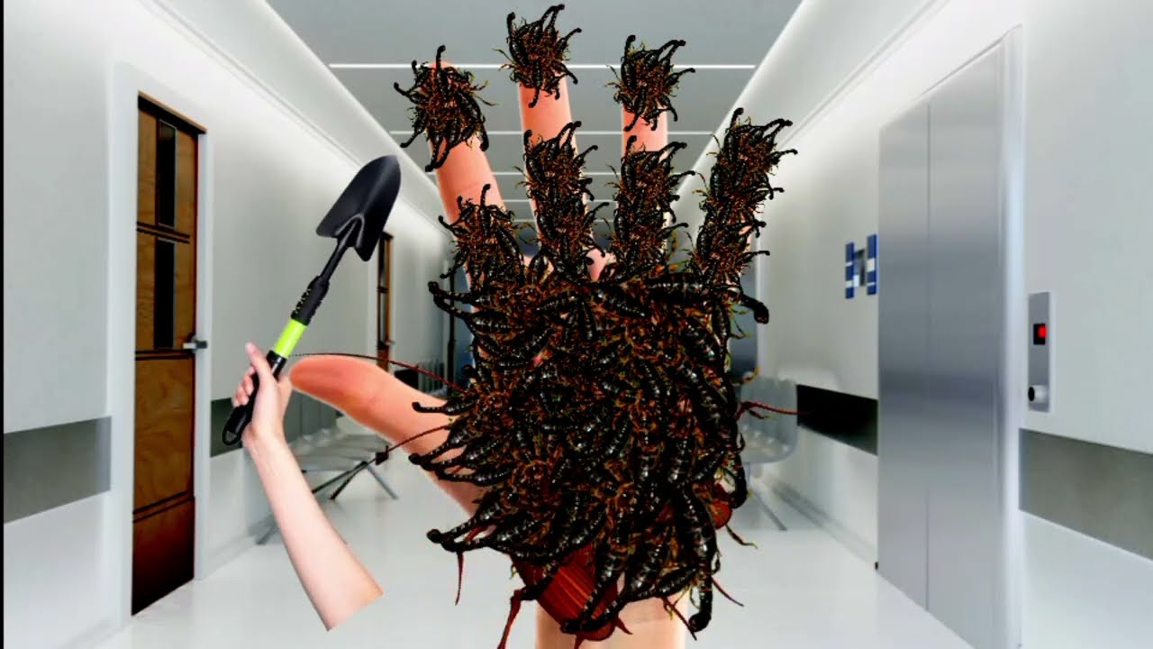 ASMR removal trypophobia & scorpion infected hand & fingure | ASMR hand ...