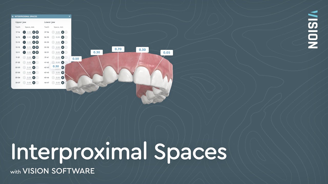 Interproximal Spaces - YouTube