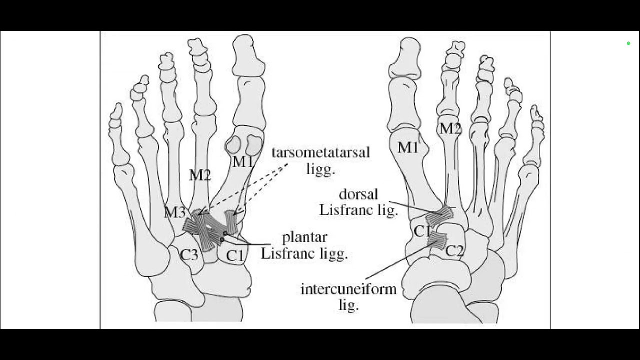 MSK RADIOLOGY DAHNERT(3) - YouTube