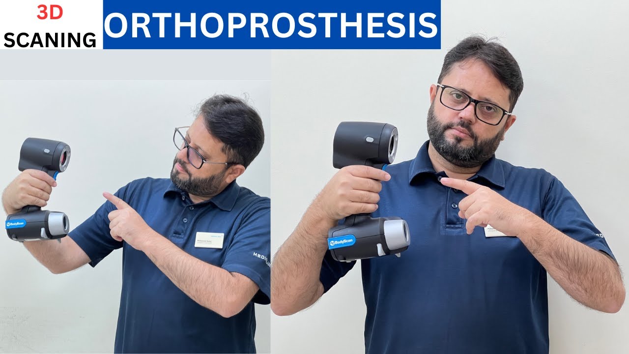 3D Scanning Of Orthoprosthesis | How to scan A model for 3D Printing in ...